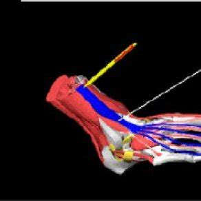 Two Screenshots From An Animation For Anatomy Education The Initial