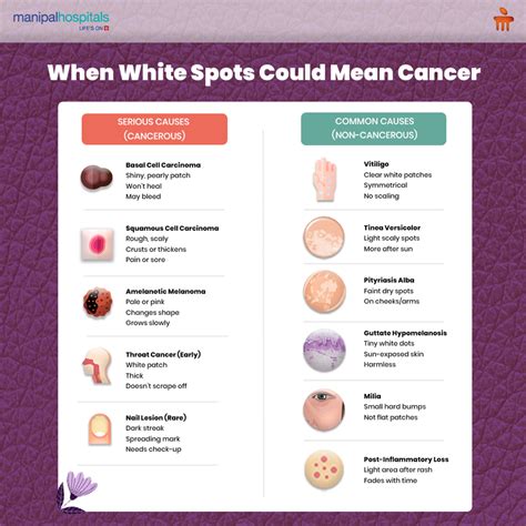 White Spots On Skin Causes And Cancer Risk