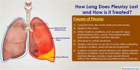 How Long Does Pleurisy Last And How Is It Treated