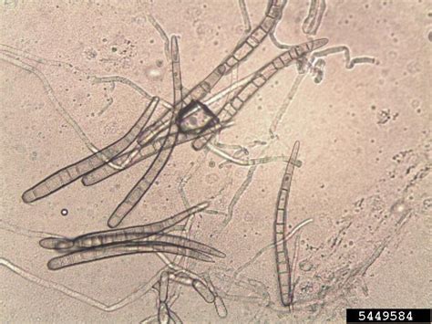 Cercospora Fungi Genus Cercospora Fresen