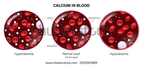 Hypercalcemia Normal Level Hypocalcemia Calcium Blood Stock Vector