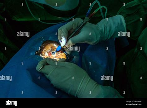 Bogor Indonesia March 27 2023 Doctors Perform Cataract Eye Surgery On Patients Using The