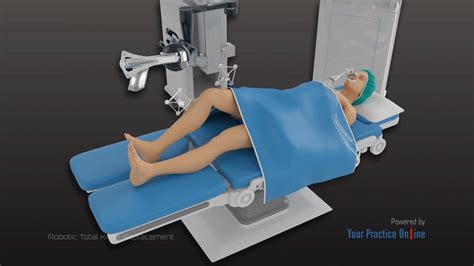 What Is Total Knee Replacement Surgery