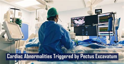 Case Of Cardiac Abnormalities Triggered By Pectus Excavatum Medsynapse