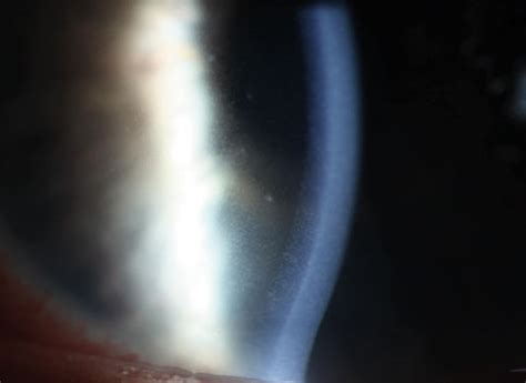 Lesson Identifying Systemic Sources Of Uveitis