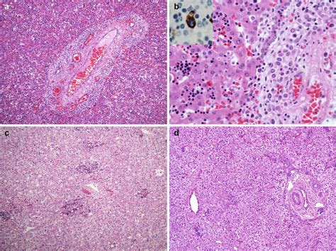 Normal And Abnormal Liver Development Abdominal Key