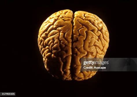 Frontal Lobe Brain Photos And Premium High Res Pictures Getty Images