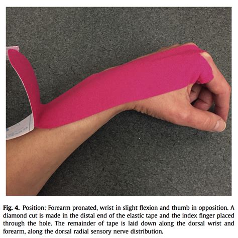 Taping Techniques For The Wrist Rigid Tape And Kinesiology Tape