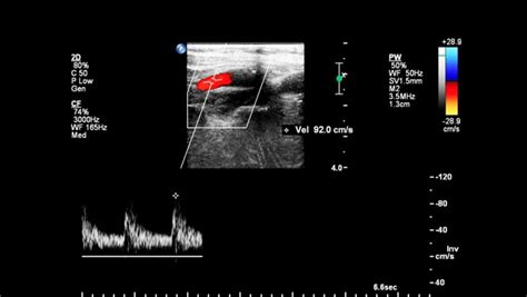 Doctor Examining Color Doppler Ultrasound Royalty Free Images Stock