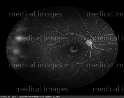 Stock Image Je7476 01b470qw Science Source Search Medical