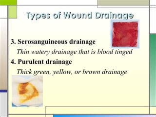 Sanguineous Wound