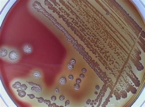 Bacillus Pumilus Culture At ₹ 600kg Bacillus Subtilis In Bengaluru