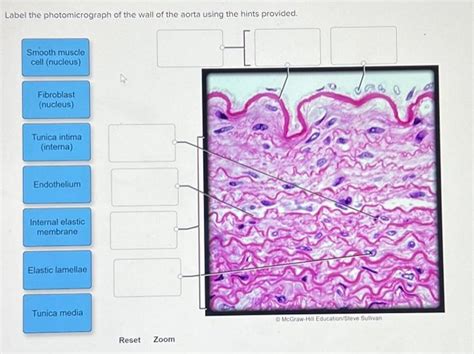 Solved Label The Photomicrograph Of The Wall Of The Aorta