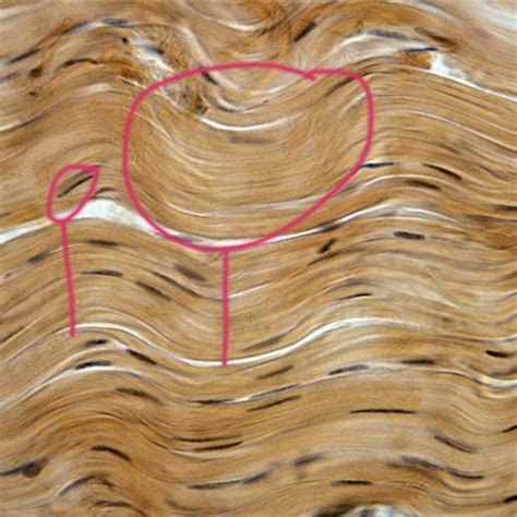 Dense Regular Dense Connective Tissue Diagram Quizlet