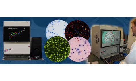 Cellular Technology Limited Ctl Cell Mediated Immune Monitoring