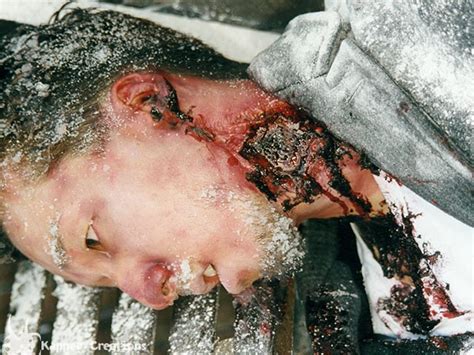 Frozen Corpse