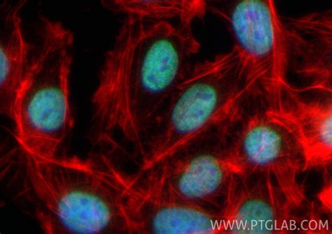 Mll4 Antibody 84410 3 Pbs Proteintech