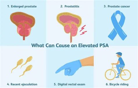 How To Treat Elevated Psa Levels