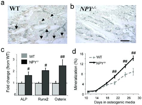 Npy Expression And Action In Bone Tissue A Analysis Of Npy