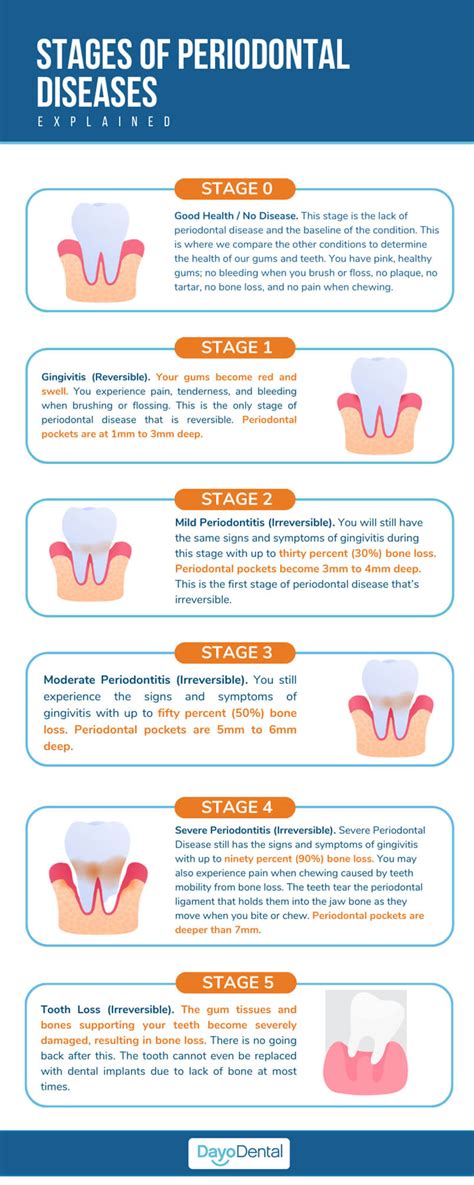 Periodontitis Symptoms 464x189