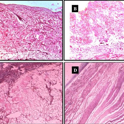Conservation Of Ecm 3d Structure Of Acellular Scaffolds Sem Of The Download Scientific Diagram