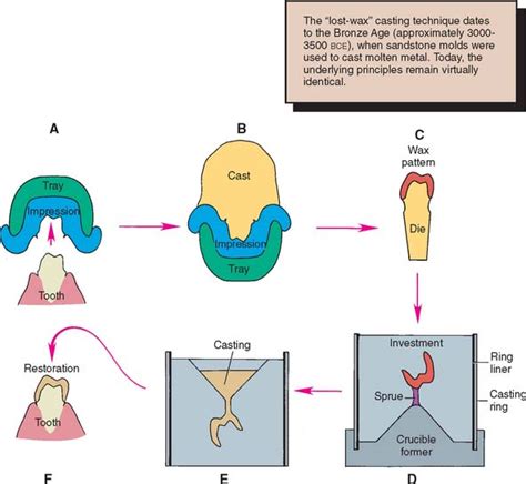 18 Wax Patterns Pocket Dentistry