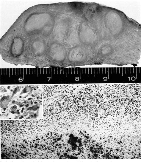 Figure 1 From Calcinosis Circumscripta In The Buffalo Bos Bubalis