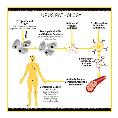 Lupus Disease Biology At Diana Massey Blog