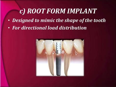 Types And Classification Of Dental Implants