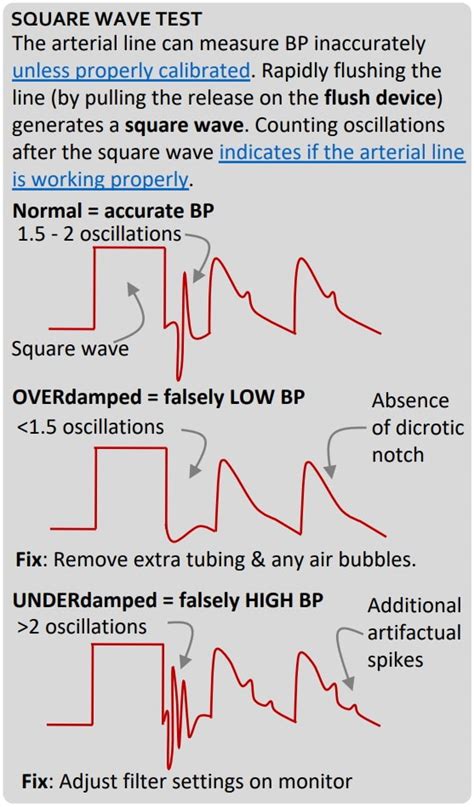 The Square Wave Anesthesia And Intensive Care Knowledge