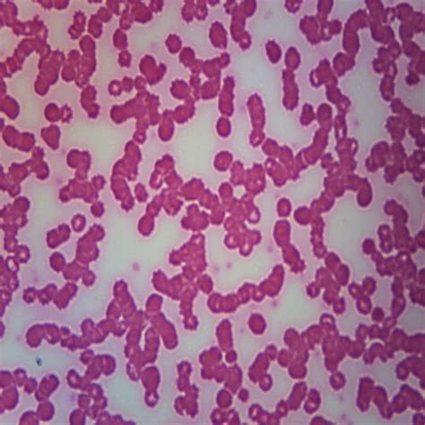 Eosinophils Microscope