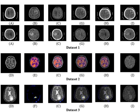 Experiment Results On Images A Ct Image B Mri Image C Fused