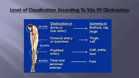 Chronic Peripheral Arterial Occlusive Disease Lower Limb Ppt