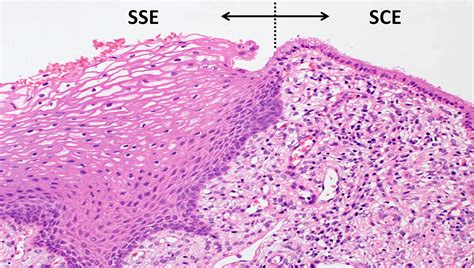 Vocal Cord Histology