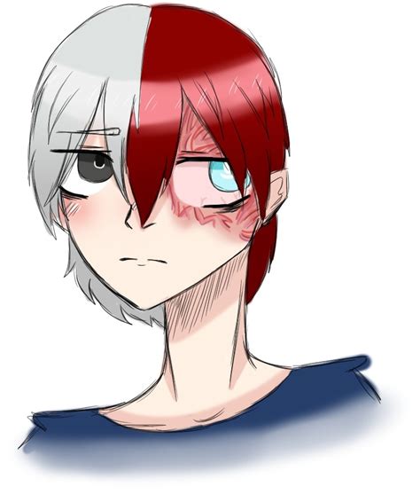 Why Is Todoroki S Face Burned At Jorge Damon Blog