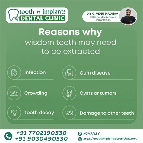 Tooth 🦷 Wisdom Teeth Troubles Know Why Removal May Be Necessary 🦷