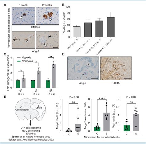 Figure 2 From Disturbance In Cerebral Blood Microcirculation And