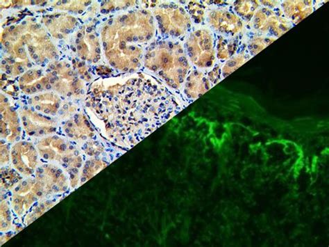 Fibrinogen Antibody Polyclonal Bio Sb