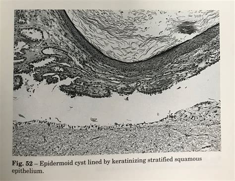 International Histological Classification V