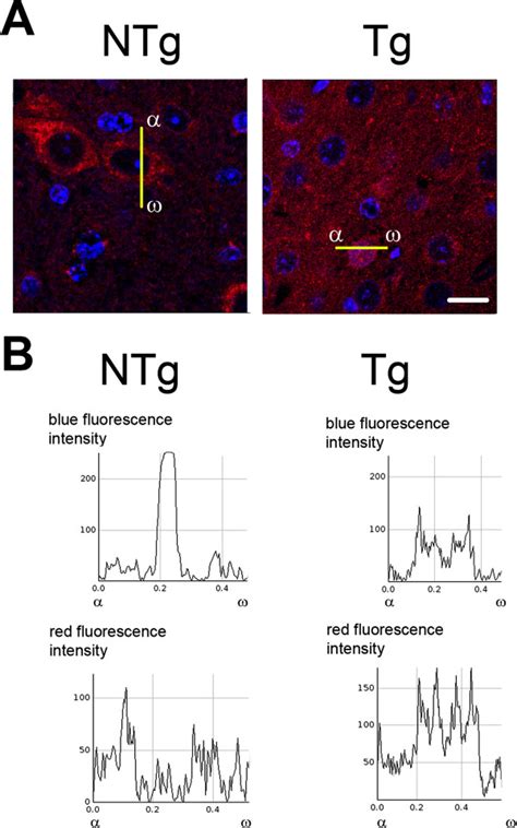 Confocal Microscopy Analysis Of Subcellular Distribution Of Aif In The