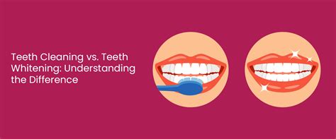 Teeth Cleaning Vs Teeth Whitening Key Differences And Benefits