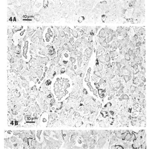 Serially Sectioned Field From Pituitary 12 H After Castration Fixed