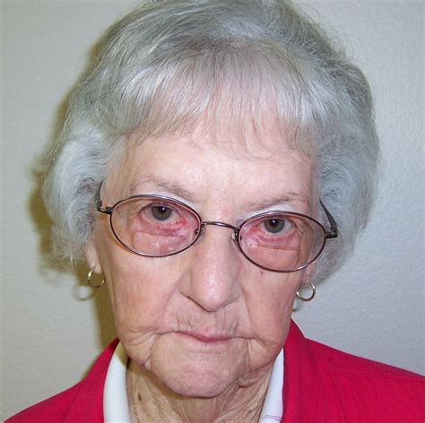 Denture Stabilization Mini Dental Implants In Central Florida