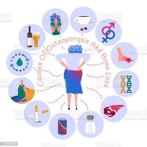 Causes Of Osteoporosis And Bone Loss Stock Illustration Download