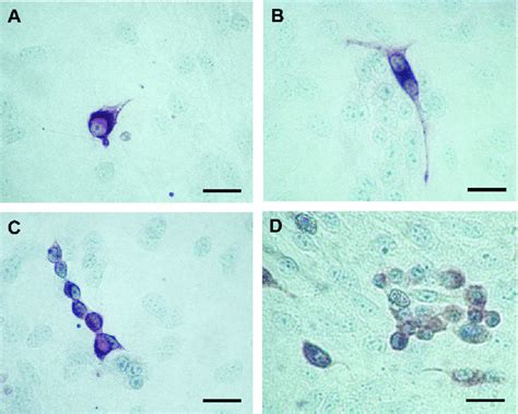 Composition Of A Spermatogonial Clones As Demonstrated By Dba Lectin