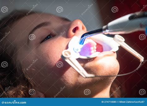 The Dentist Uses An Ultraviolet Lamp While Fitting The Girl With Braces Stock Image Image Of