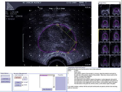 A Snapshot Of The Graphical User Interface For Automatic Prostate