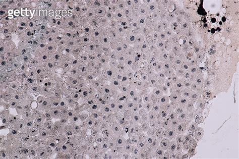 Education Of Grasshopper Testis Under The Microscope In Lab 1179973891 게티이미지뱅크