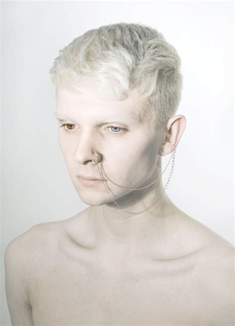 Albino Artofit