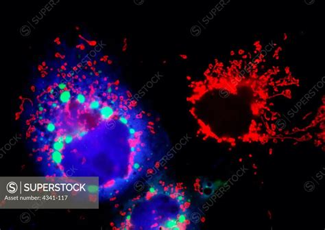 Comparing Mutant Cell And Normal Cell Microscopic View Superstock
